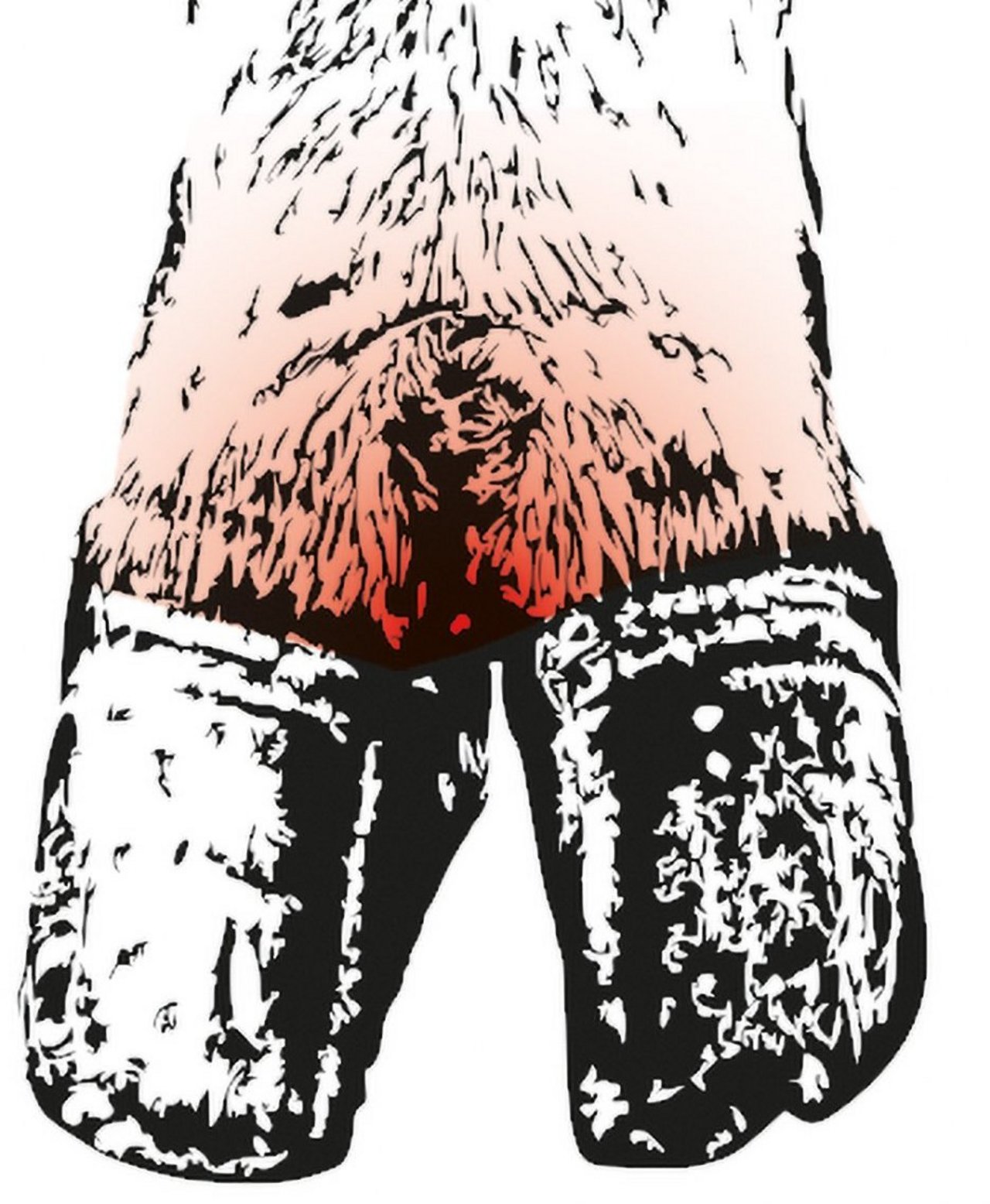 «Beim Auftreten von Panaritium ist es wichtig, dass das Rind sofort ...