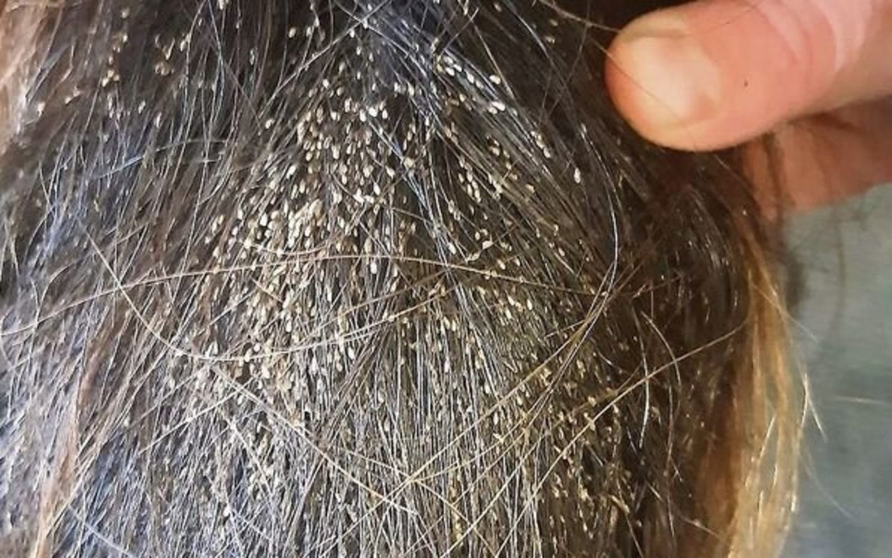 Im Winter ist Vorsicht vor Haarlingen geboten - bauernzeitung.ch ...